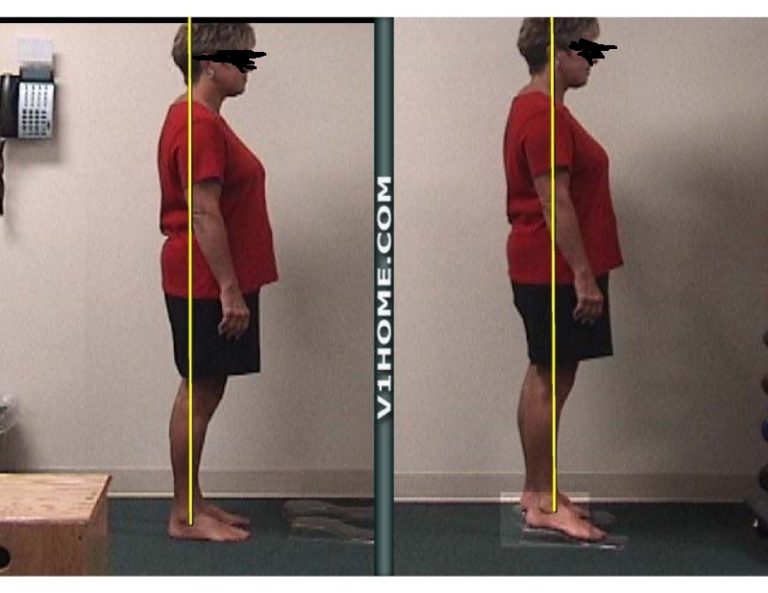 high arch rigid foot side view posture - Damien Howell PT